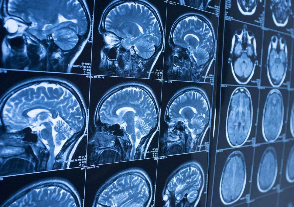Full Body CT Scan Services NJ Edison Elizabeth USA