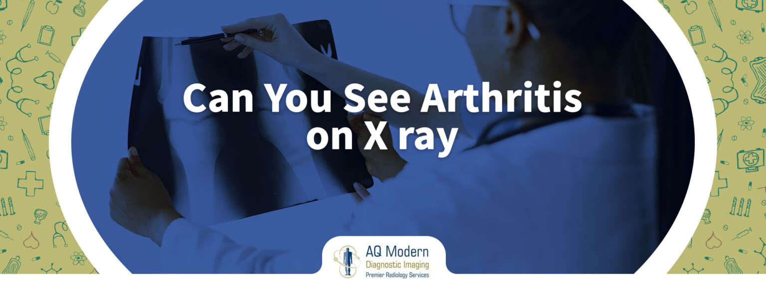 Can You See Arthritis On An X-Ray - AQ Imaging Network