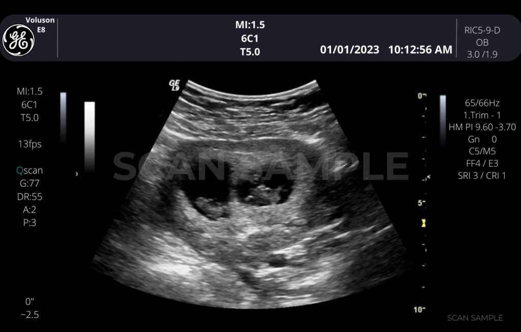 How to Spot a Fake Ultrasound - AQ Imaging Network