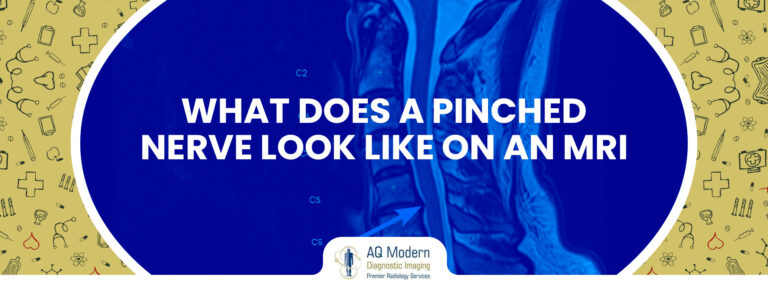 What Does a Pinched Nerve Look Like on an MRI? - AQ Imaging Network